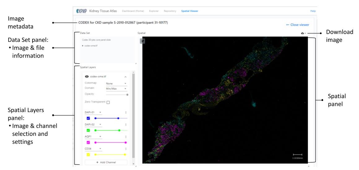 How to use the Atlas